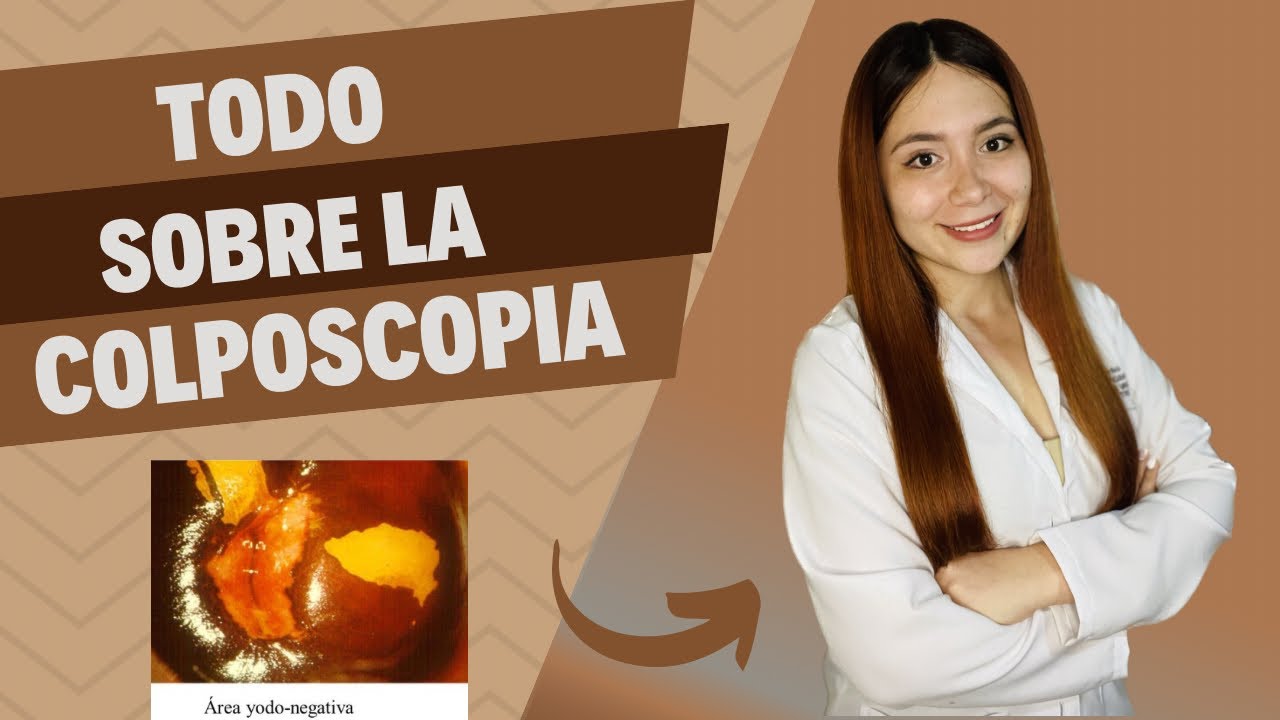 Manual de Colposcopia para Principiantes en PDF: Guía Completa | UNIGAL